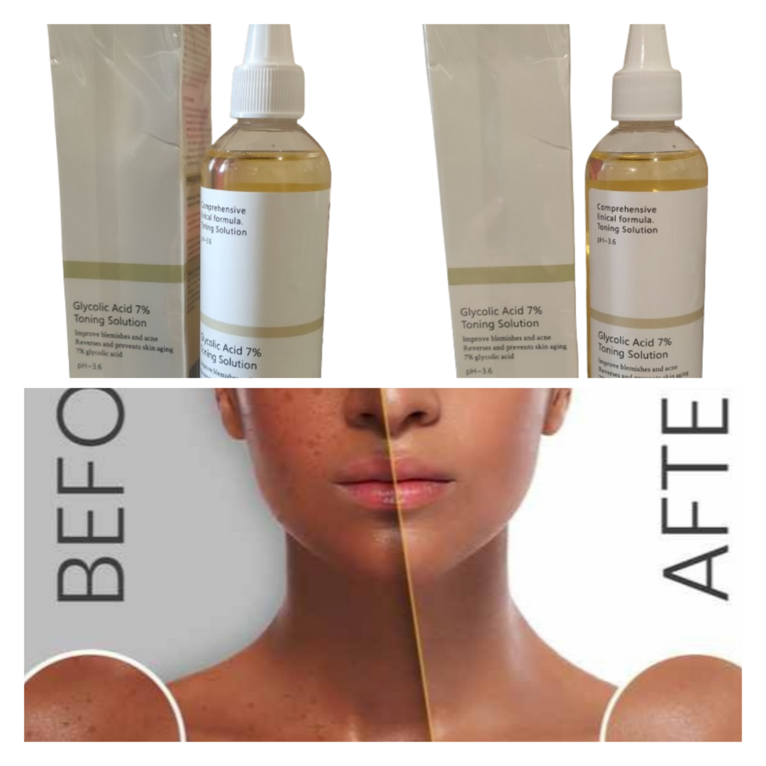 ACIDE GLYCOLIQUE 7% SERUM ANTI IMPERFECTIONS POUR LE VISAGE ET LE CORPS ...