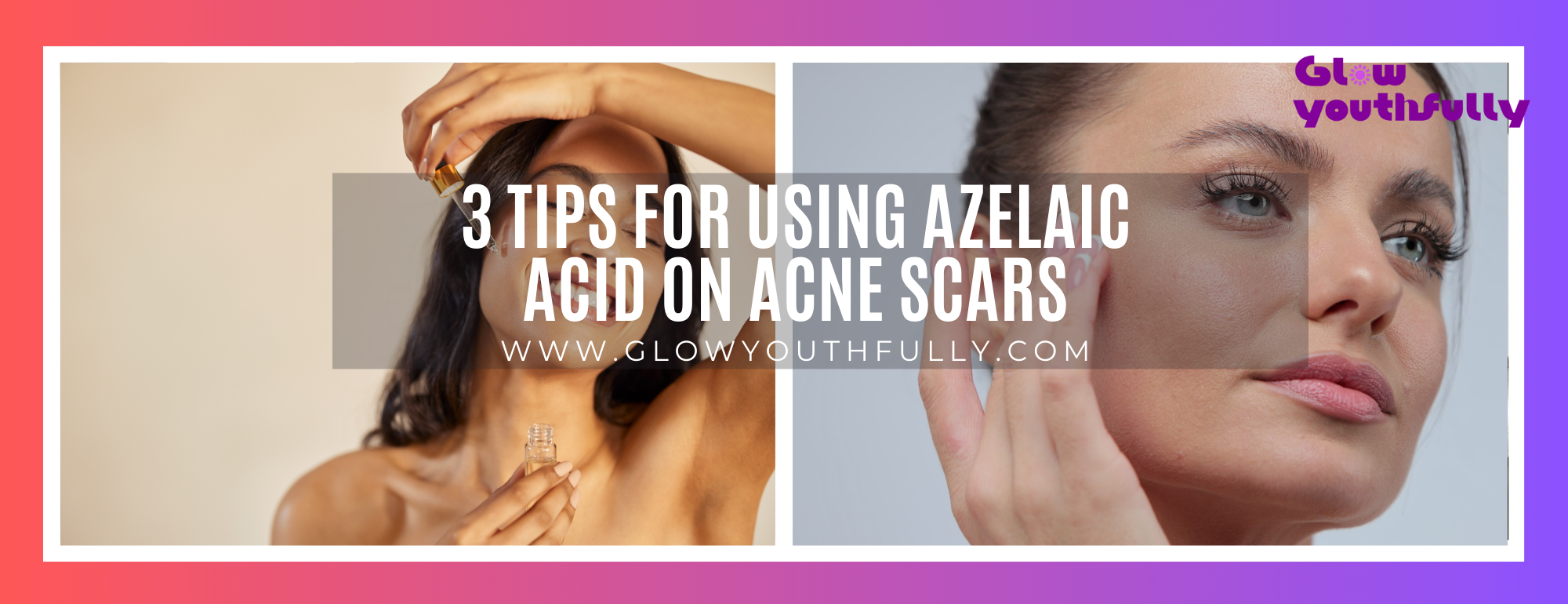 3 Tips for Using Azelaic Acid on Acne Scars - Glow Youthfully